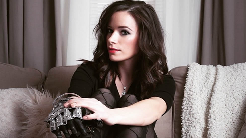 Rebekah Marine: la historia de superación de la modelo con brazo ...