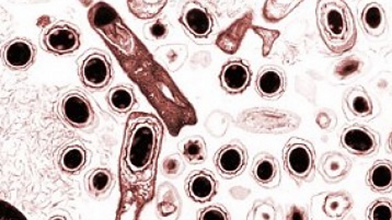 ¿Por qué el ántrax vuelve a ser un peligro?